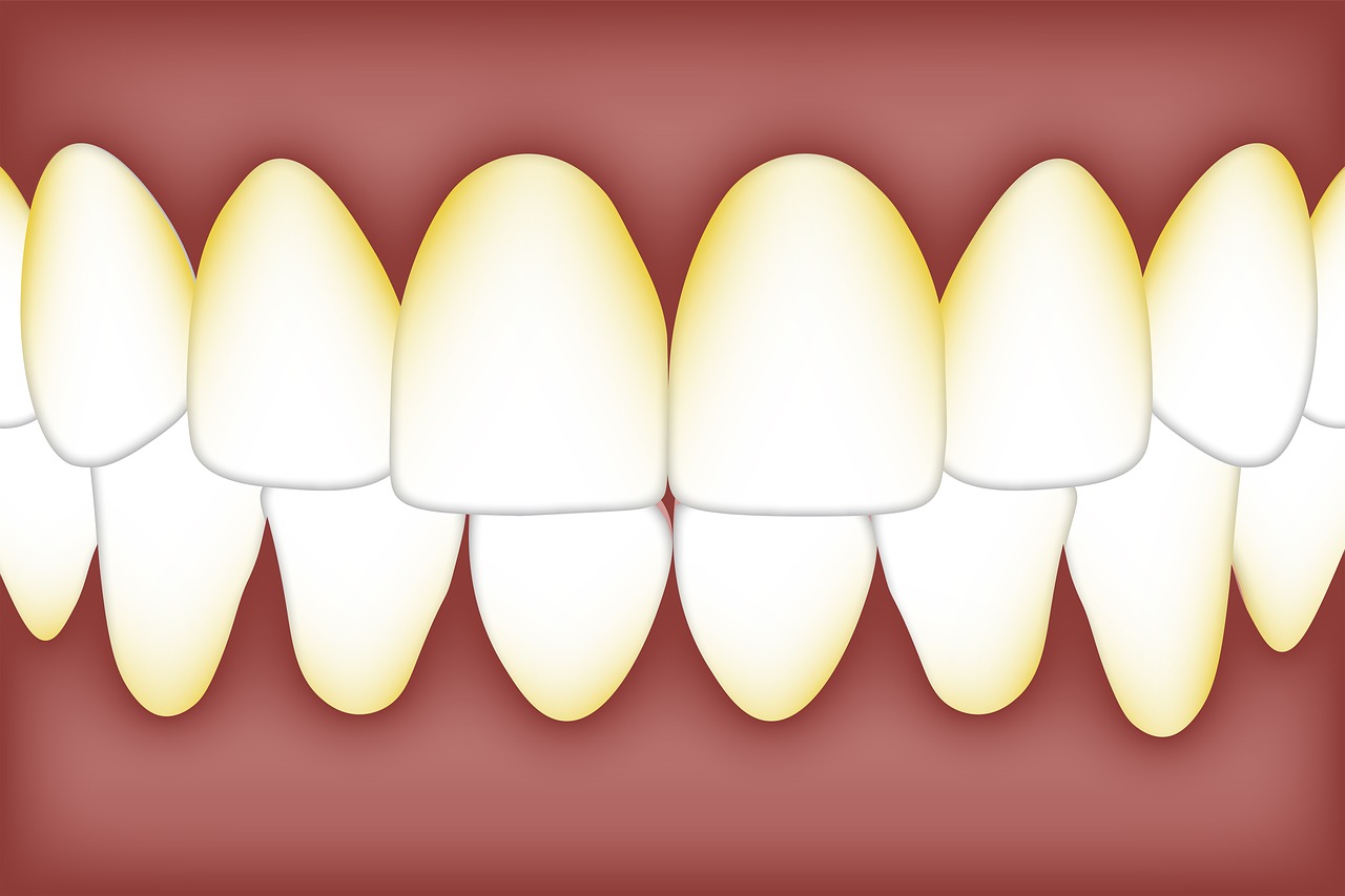 Buone regole per prevenire placca e tartaro ai denti